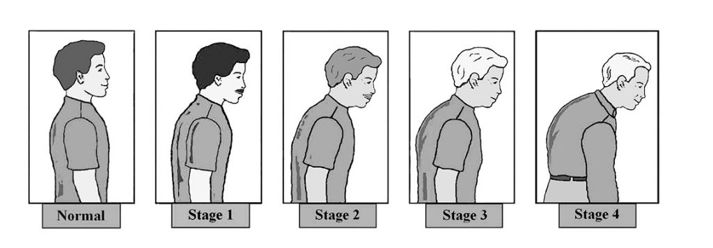 Neck and Back Pain - Novant Health Physical Therapy